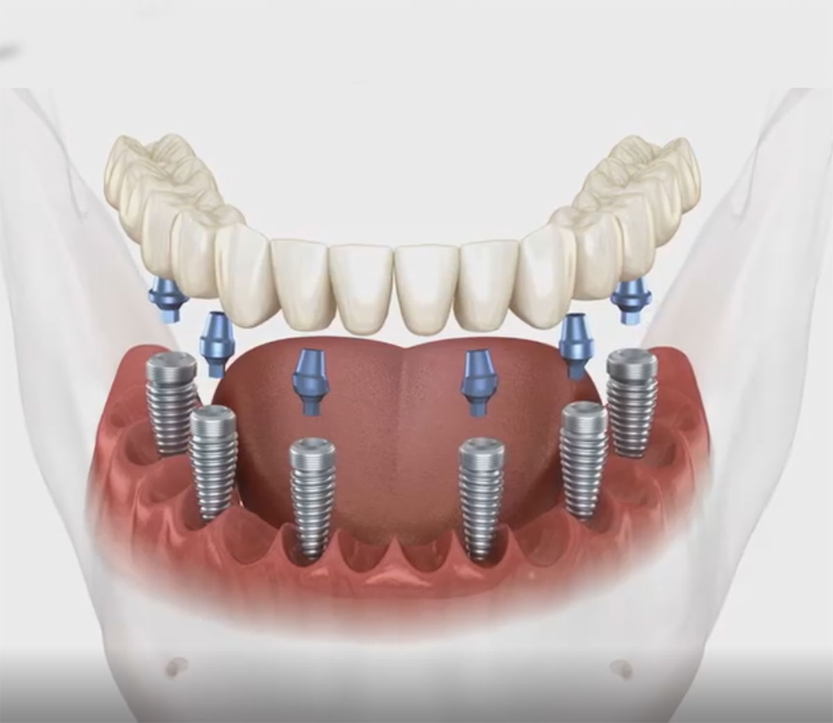 Informazioni su all on four all on six all on eight in Albania a Tirana